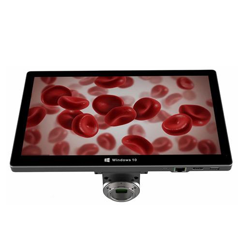 Windows 10 LCD Tablet With Built-in 16.0MP Microscope Camera – Albenth ...