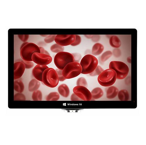 Windows 10 LCD Tablet With Built-in 16.0MP Microscope Camera – Albenth ...